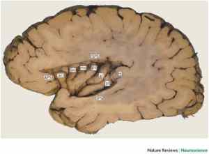 Insula Cortex | What Is It?, Location, Function, Facts & Summary